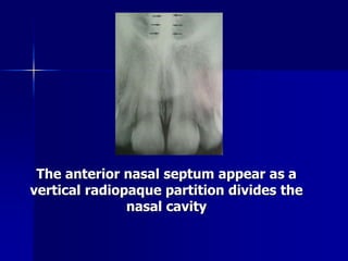 Radiographic Anatomical Landmarks | PPSX