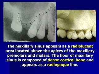Radiographic Anatomical Landmarks | PPSX