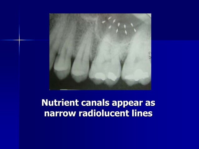 Radiographic Anatomical Landmarks | PPSX | Dental Health | Diseases and ...