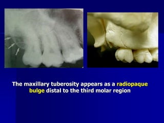 Radiographic Anatomical Landmarks | PPSX