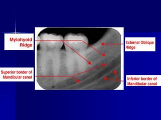 Radiographic Anatomical Landmarks | PPSX
