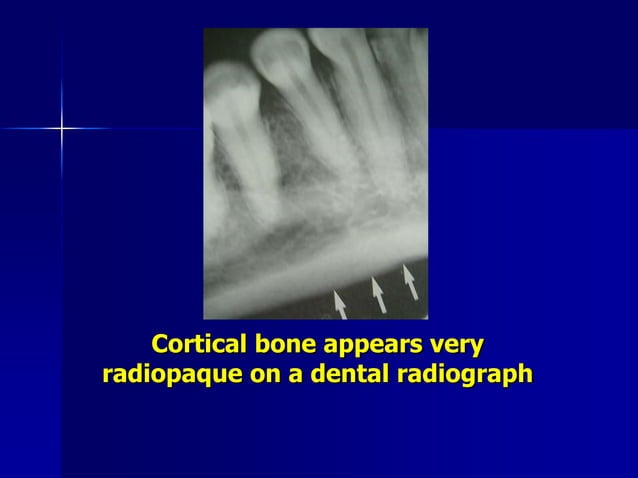 Radiographic Anatomical Landmarks | PPSX | Dental Health | Diseases and ...