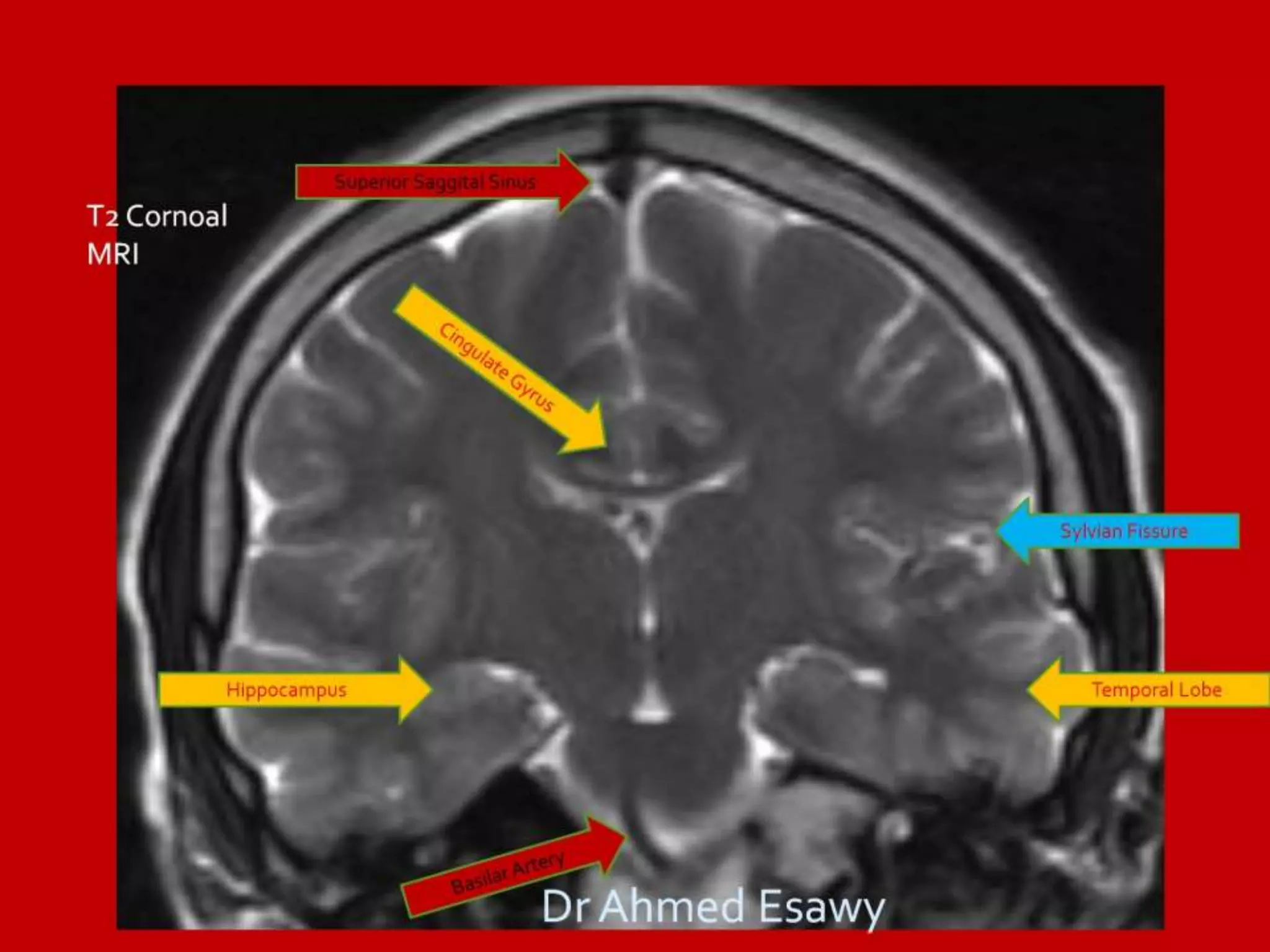 3 Dr Ahmed Esawy imaging oral board of CNS part III imaging | PPT