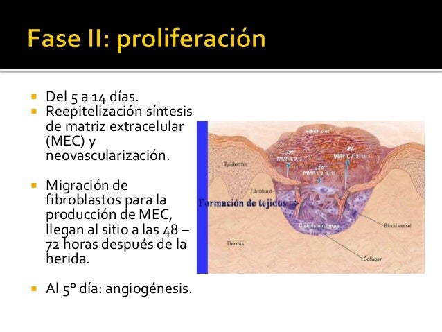 Introducción a la reparación tisular