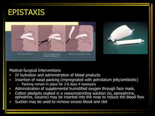 RESPIRATORY DISORDERS | PPT