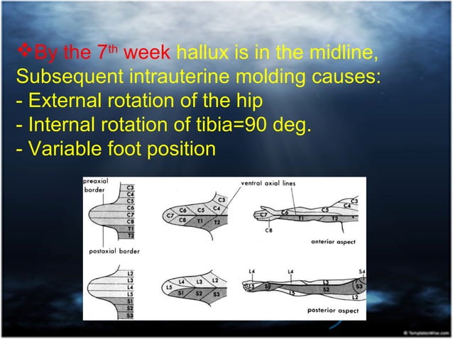 Rotational deformities of lower extremity in children | PPT | Death ...
