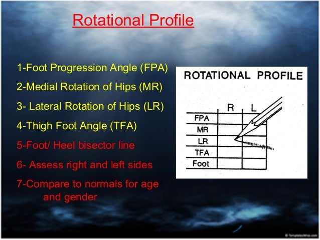 Rotational deformities of lower extremity in children