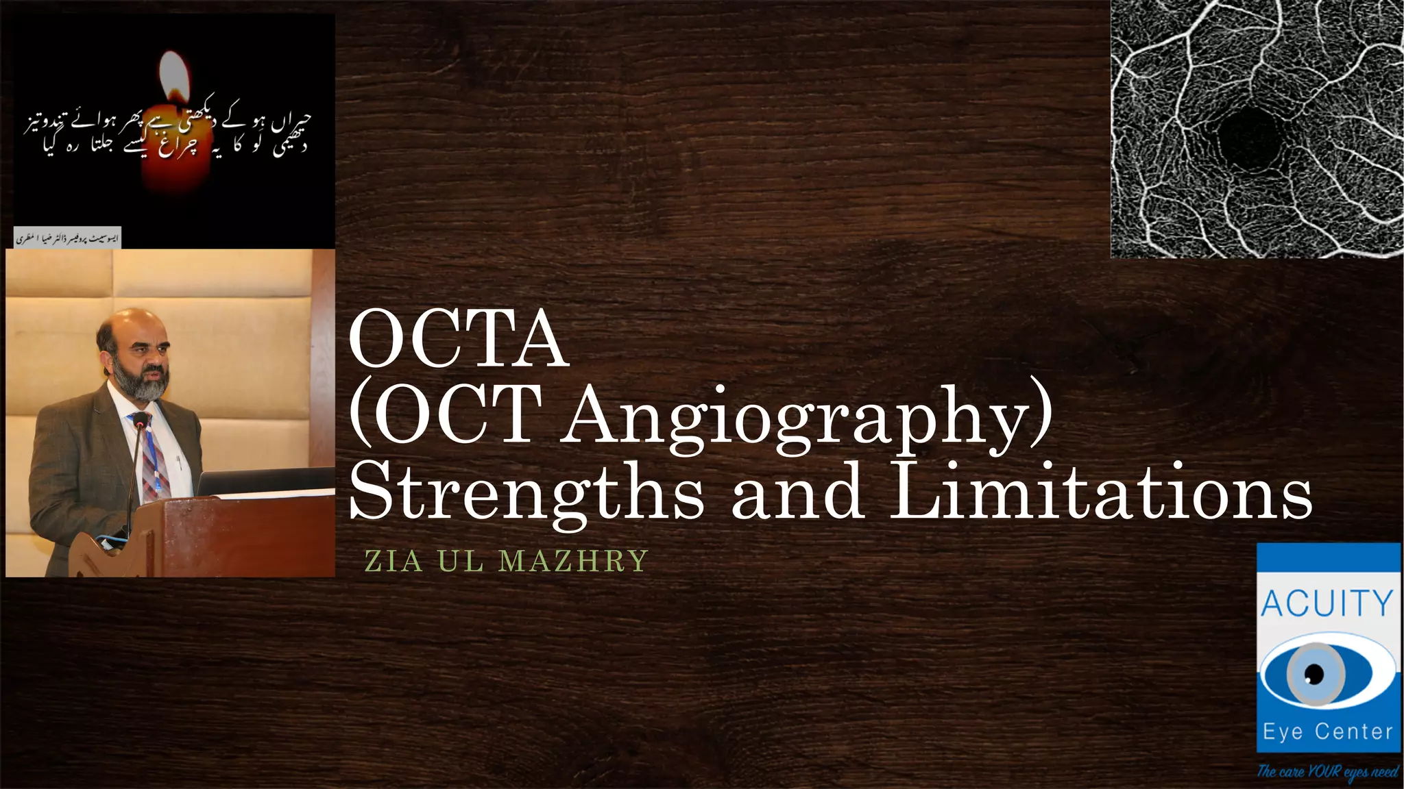 OCTA (OCT Angiography) Strengths and Limitations | PDF