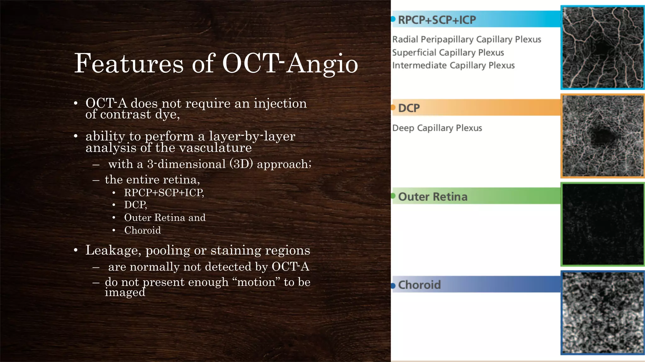 OCTA (OCT Angiography) Strengths and Limitations | PDF