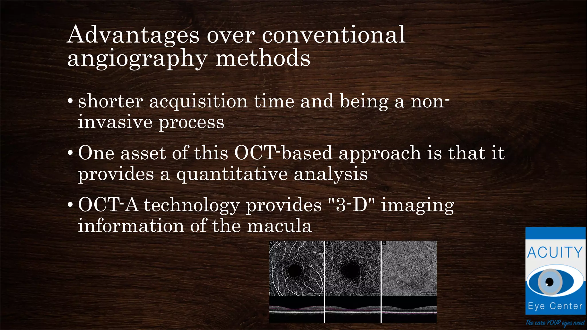 OCTA (OCT Angiography) Strengths and Limitations | PDF