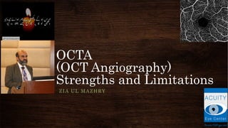 OCTA (OCT Angiography) Strengths and Limitations | PDF
