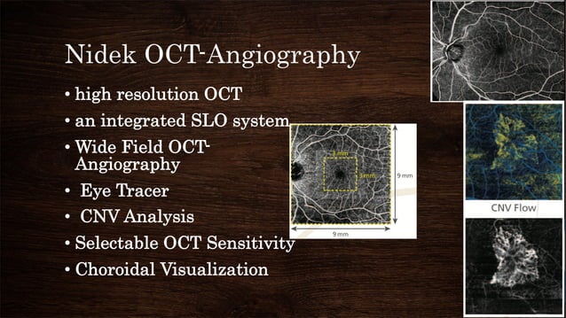 OCTA (OCT Angiography) Strengths and Limitations | PDF | Eye and Vision ...