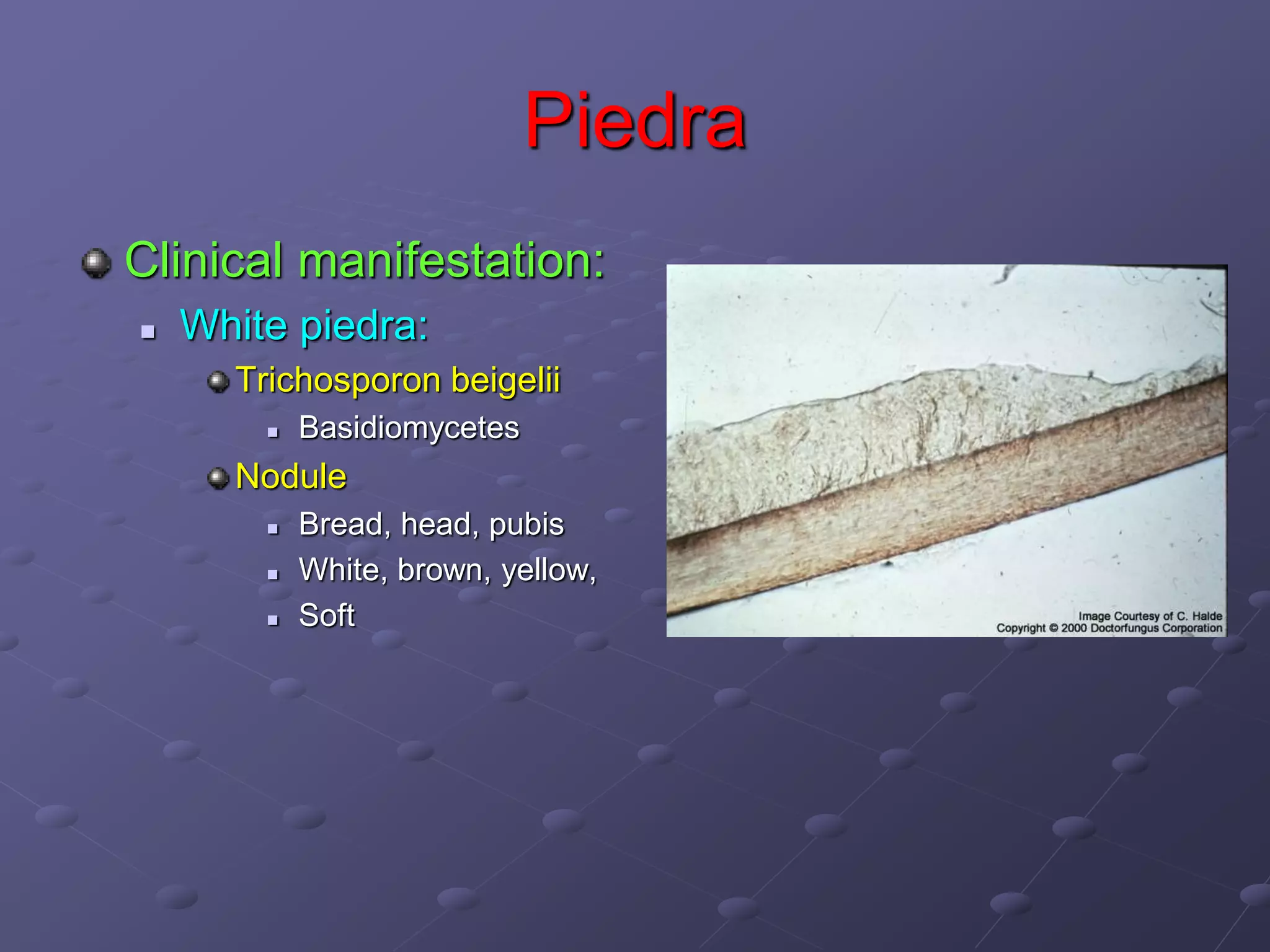 3-Superficial_mycosis__dee239cd.ppt