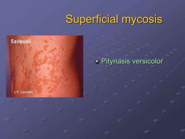 3-Superficial_mycosis__dee239cd.ppt