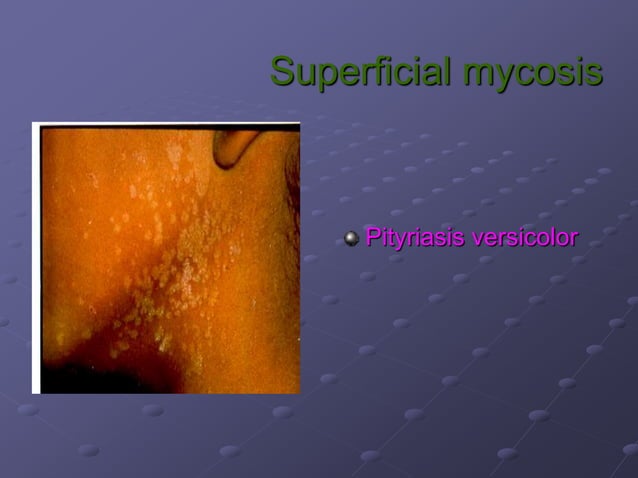 3-Superficial_mycosis__dee239cd.ppt