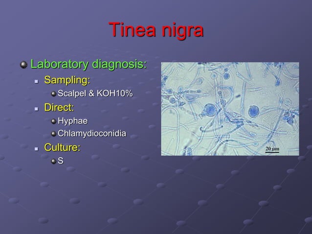 3-Superficial_mycosis__dee239cd.ppt