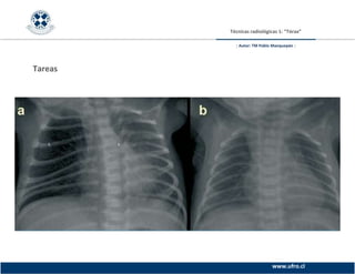 ''torax'' tecnicas radiologicas 1 modulo online | PPTX