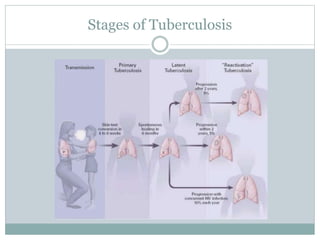 Tuberculosis MBBS FIRST YEAR MICROBIOLOGY | PPTX