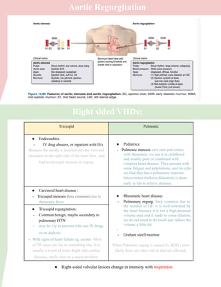3-Valvular Heart Diseases (VHD).pdf notes | PDF