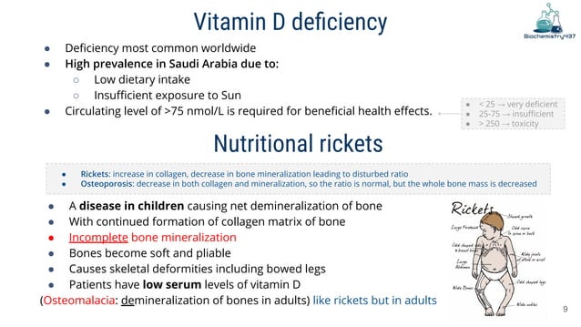 3- Vitamin D , Ricketts.pdf