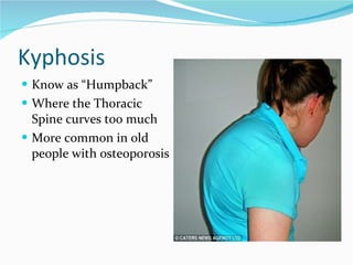 III Sem - Week 1 - The Spine | PPT