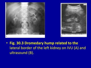 30 DAVID SUTTON PICTURES THE KIDNEY AND URETERS | PPT