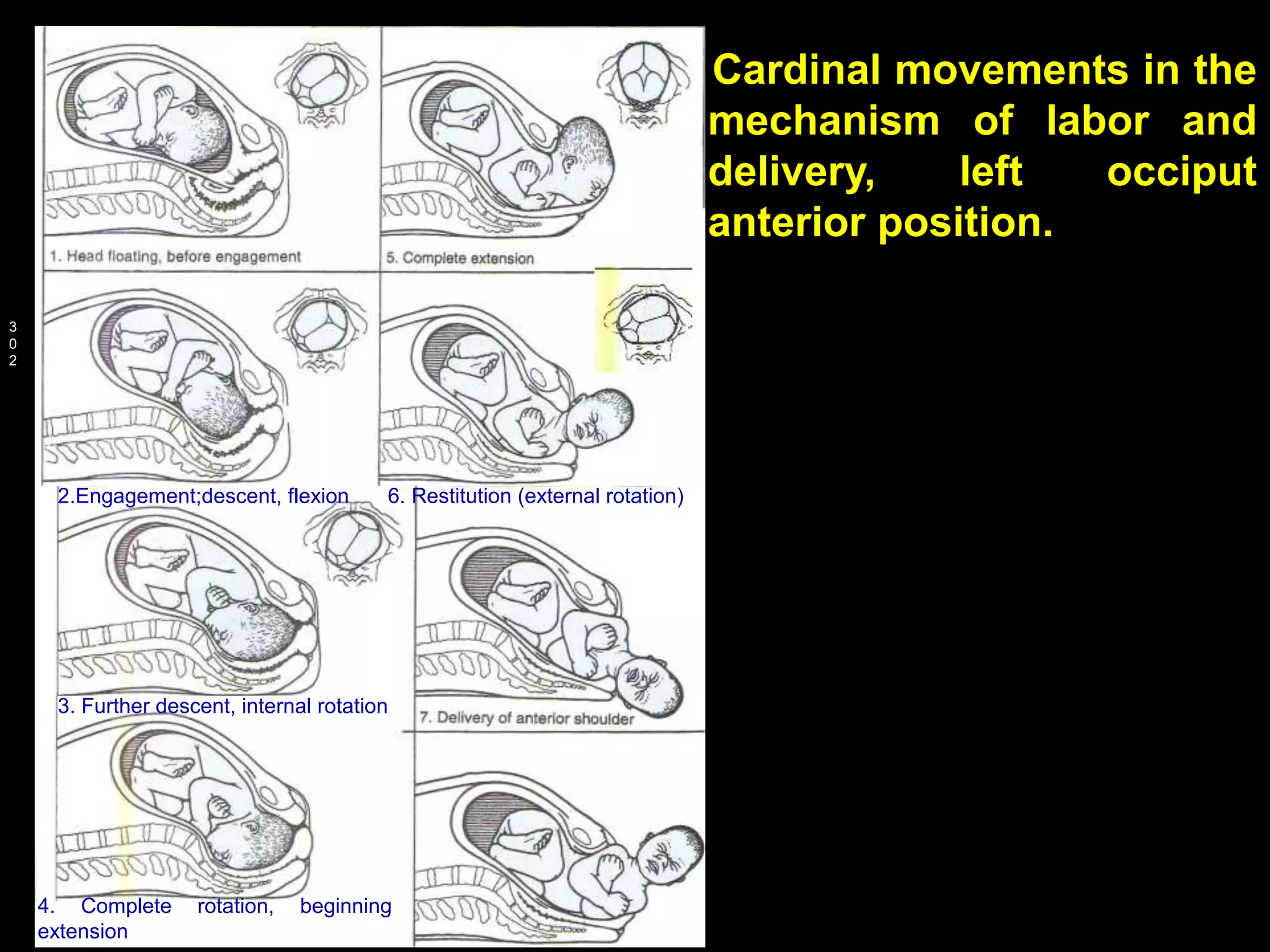 mechanism of labor.ppt