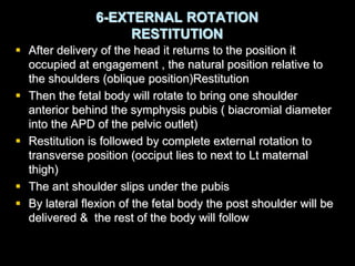 mechanism of labor.ppt