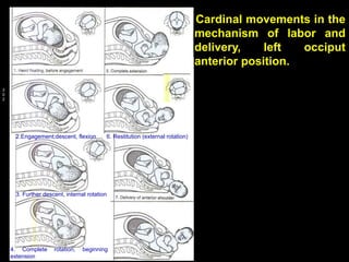 mechanism of labor.ppt