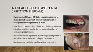 30. Connective Tissue Oral Lesions (1).pptx