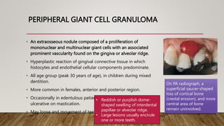 30. Connective Tissue Oral Lesions (1).pptx