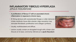 30. Connective Tissue Oral Lesions (1).pptx