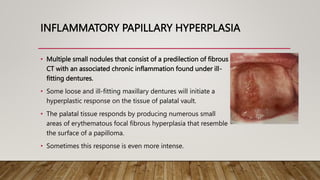 30. Connective Tissue Oral Lesions (1).pptx