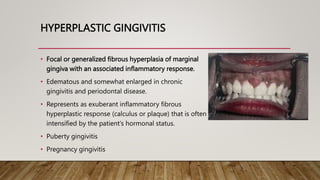 30. Connective Tissue Oral Lesions (1).pptx