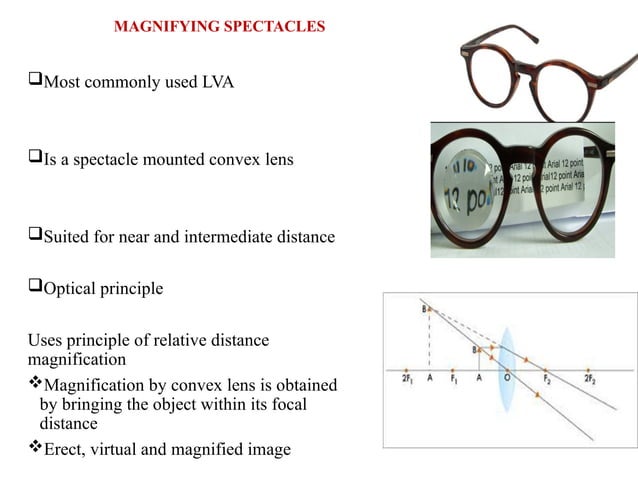 30. low vision final ophthalmology presentation.pptx