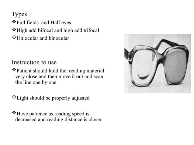30. low vision final ophthalmology presentation.pptx