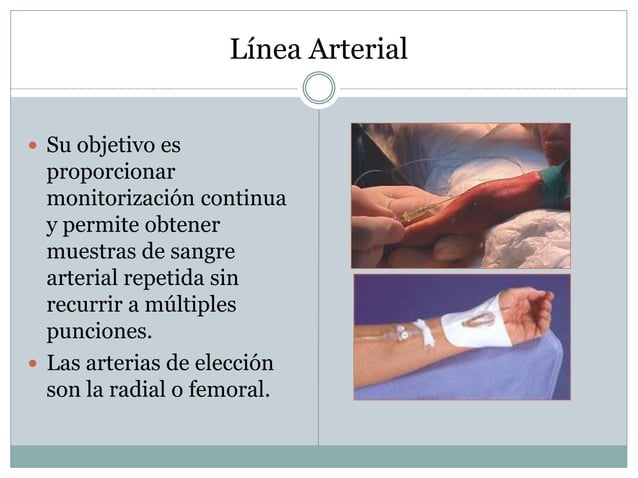 Catéter venoso central y línea arterial directa - CICAT-SALUD | PPT
