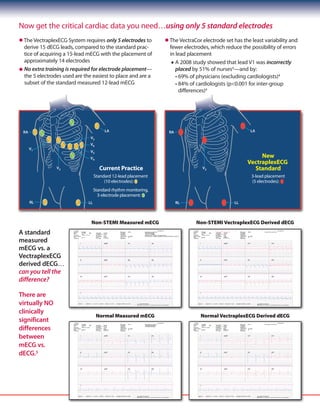 VectraplexECGFinal Brochure 3.1 | PDF