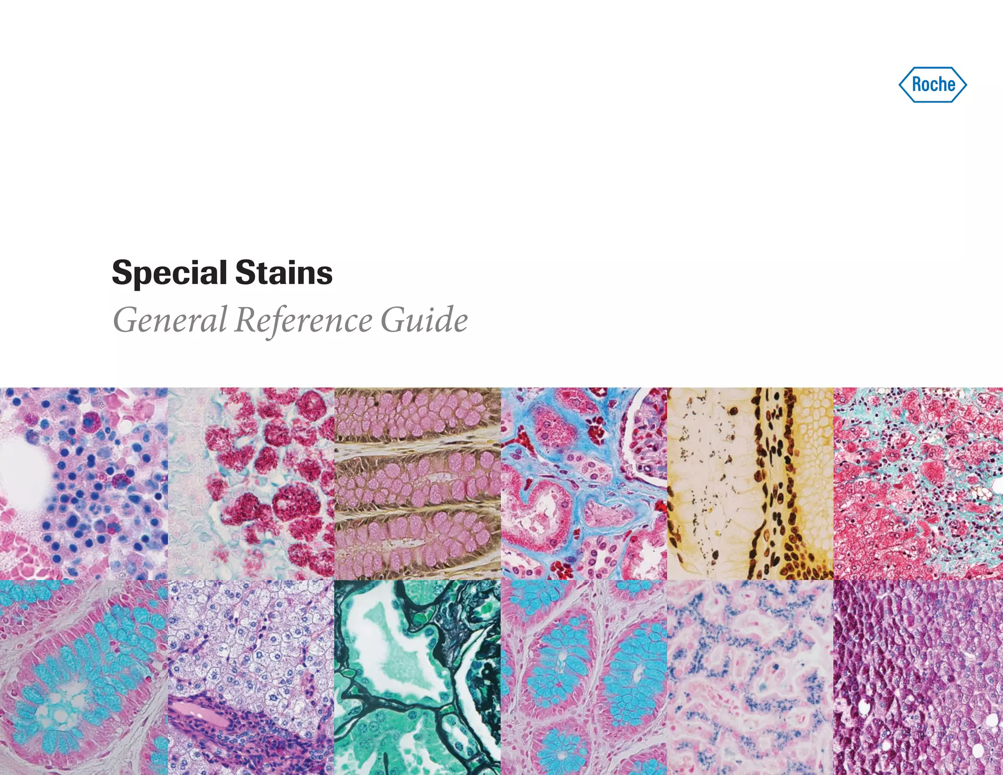 VENTANA BenchMark Special Stains General Reference Guide | PDF
