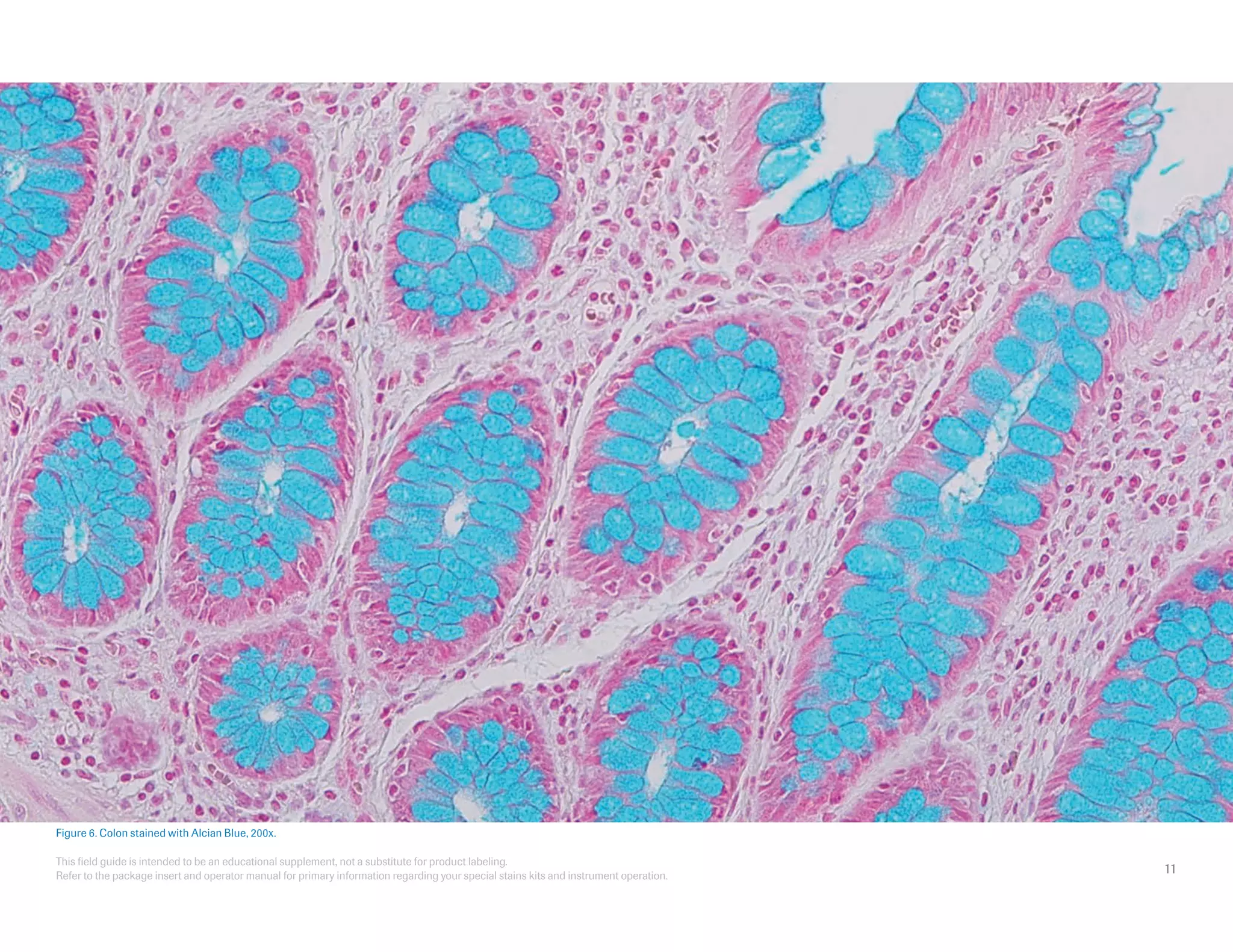 VENTANA BenchMark Special Stains General Reference Guide | PDF