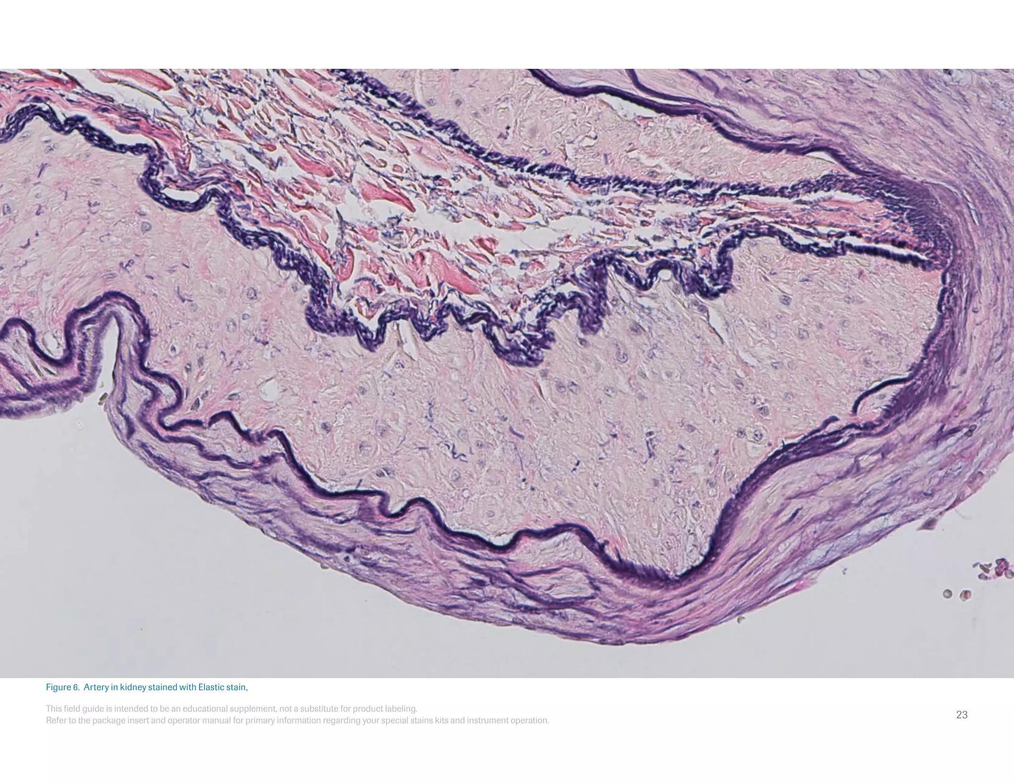 VENTANA BenchMark Special Stains General Reference Guide | PDF