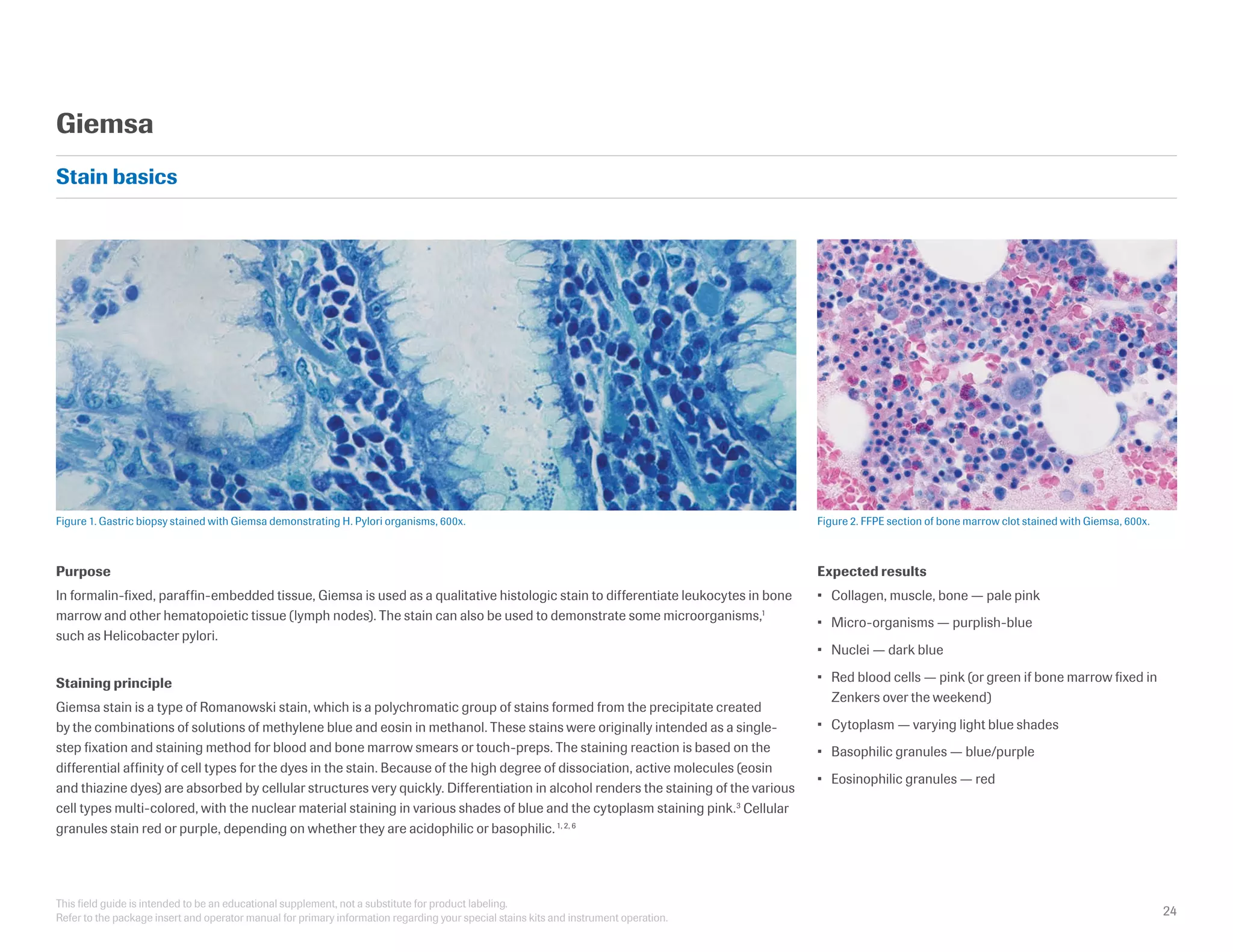 VENTANA BenchMark Special Stains General Reference Guide | PDF