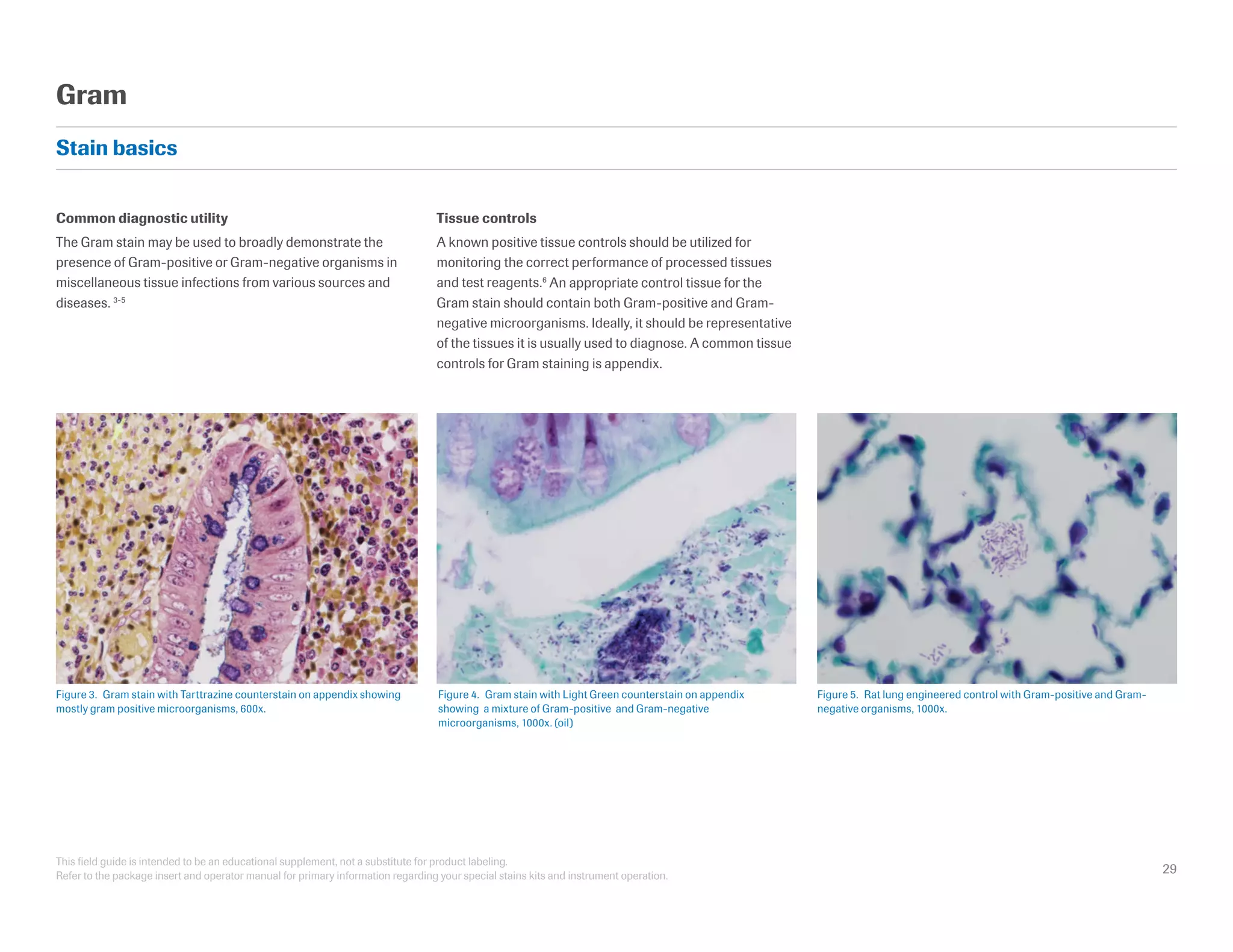 VENTANA BenchMark Special Stains General Reference Guide | PDF