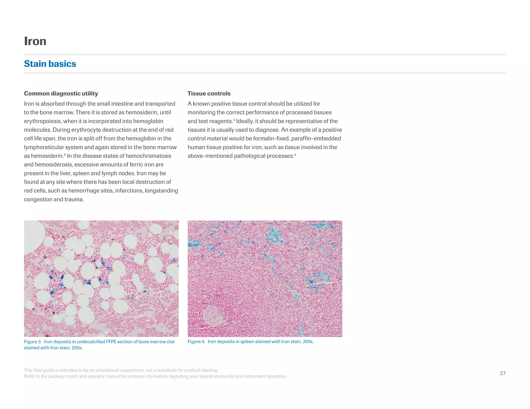VENTANA BenchMark Special Stains General Reference Guide | PDF