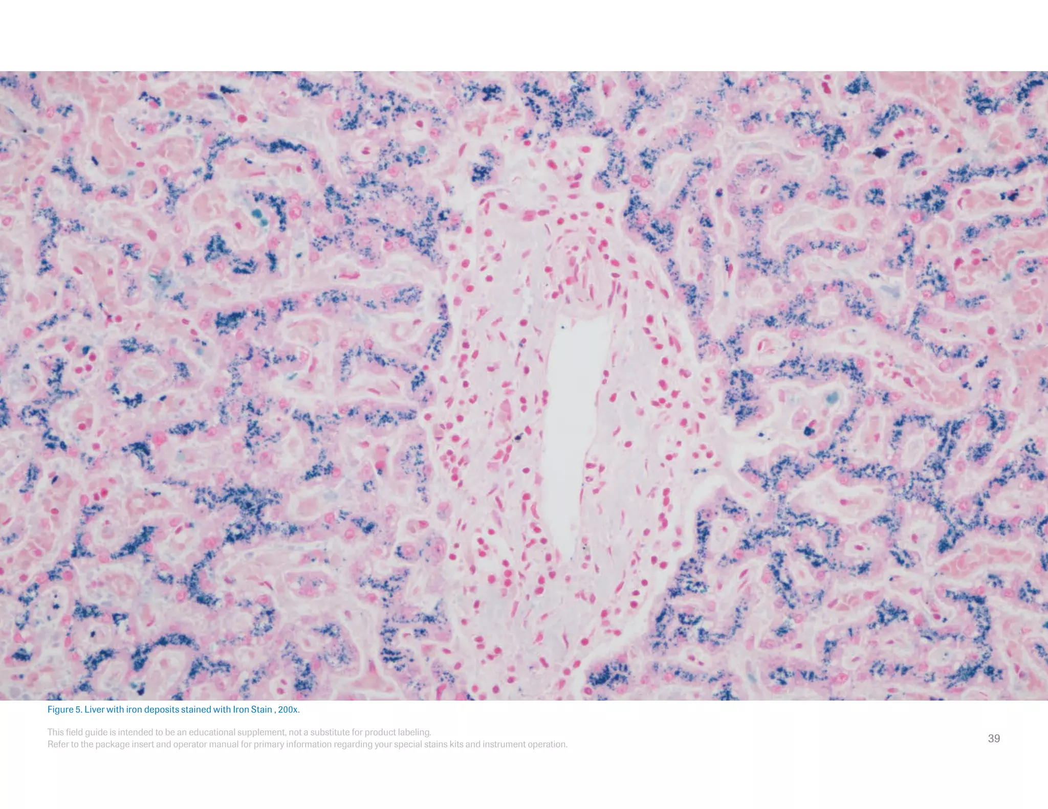 VENTANA BenchMark Special Stains General Reference Guide | PDF