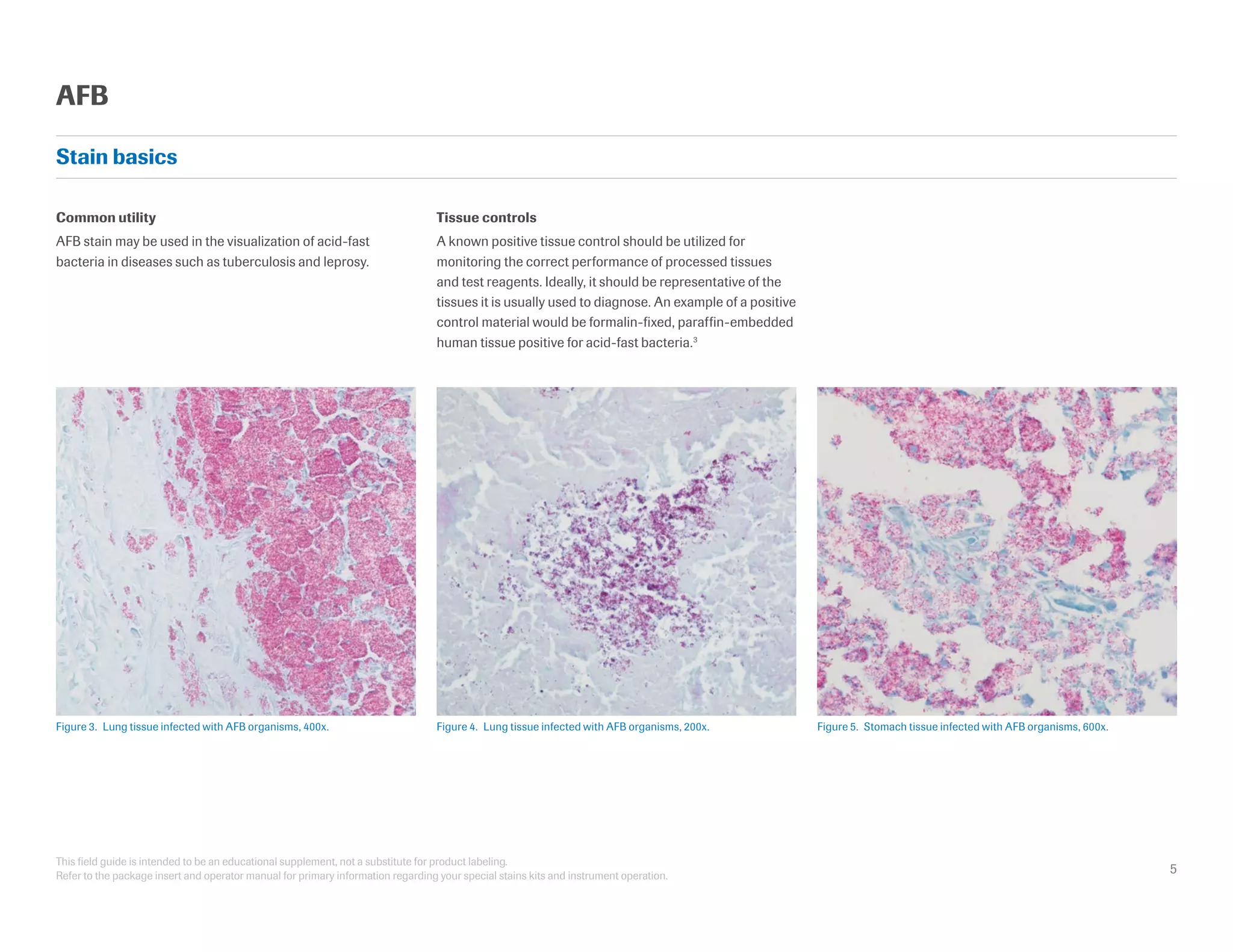 VENTANA BenchMark Special Stains General Reference Guide | PDF