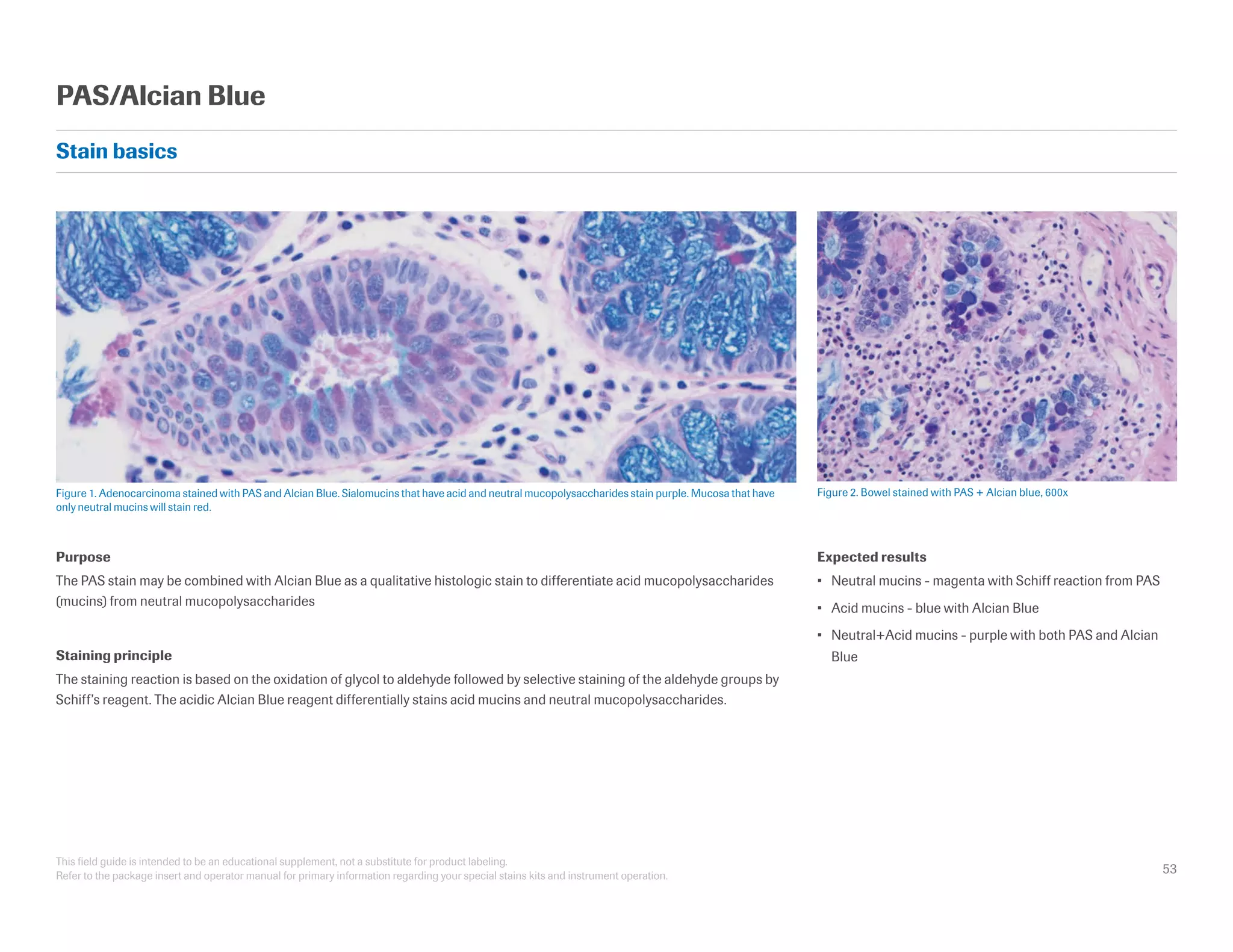 VENTANA BenchMark Special Stains General Reference Guide | PDF