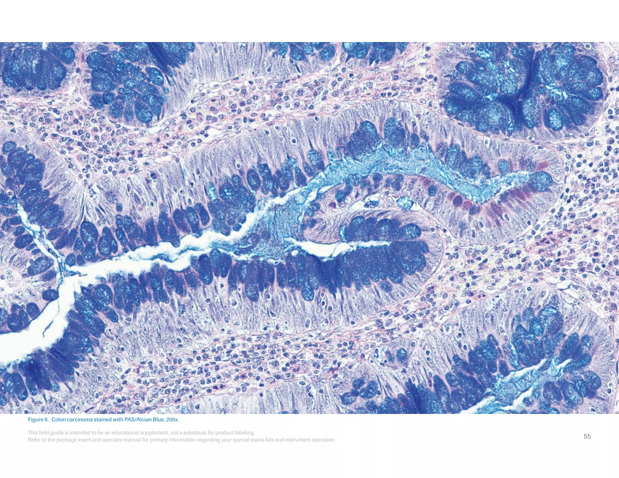 VENTANA BenchMark Special Stains General Reference Guide | PDF
