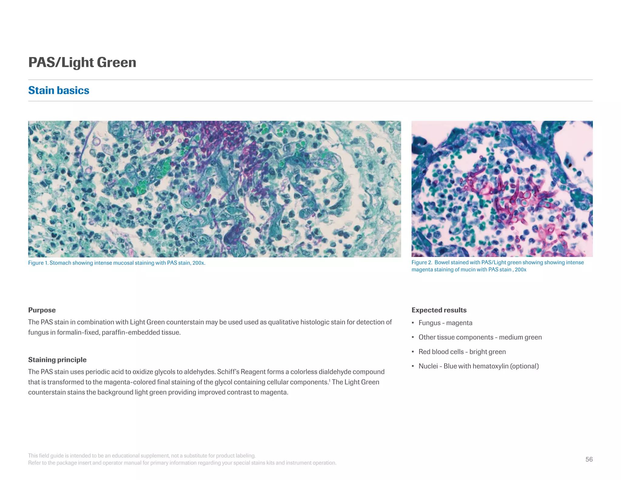 VENTANA BenchMark Special Stains General Reference Guide | PDF