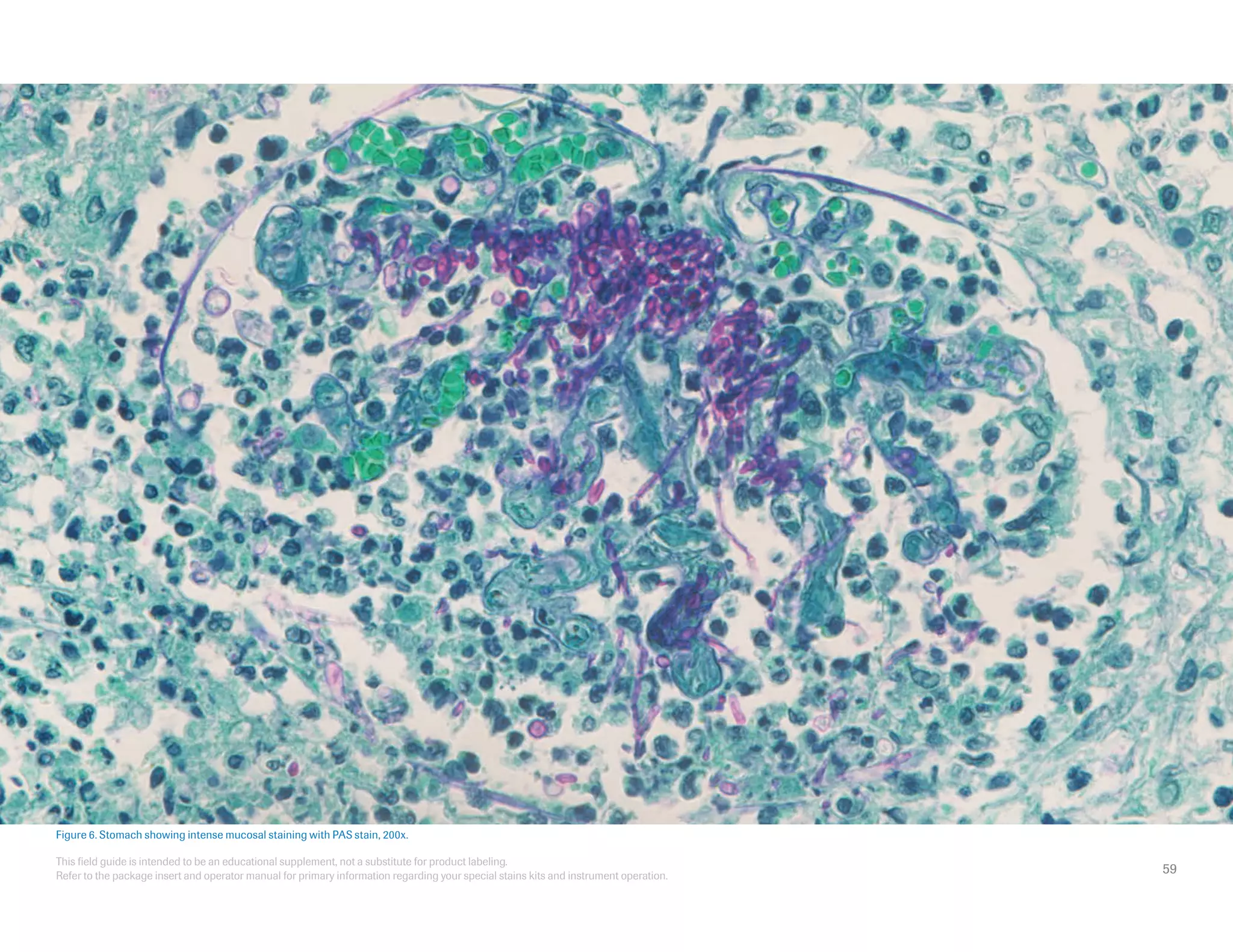VENTANA BenchMark Special Stains General Reference Guide | PDF